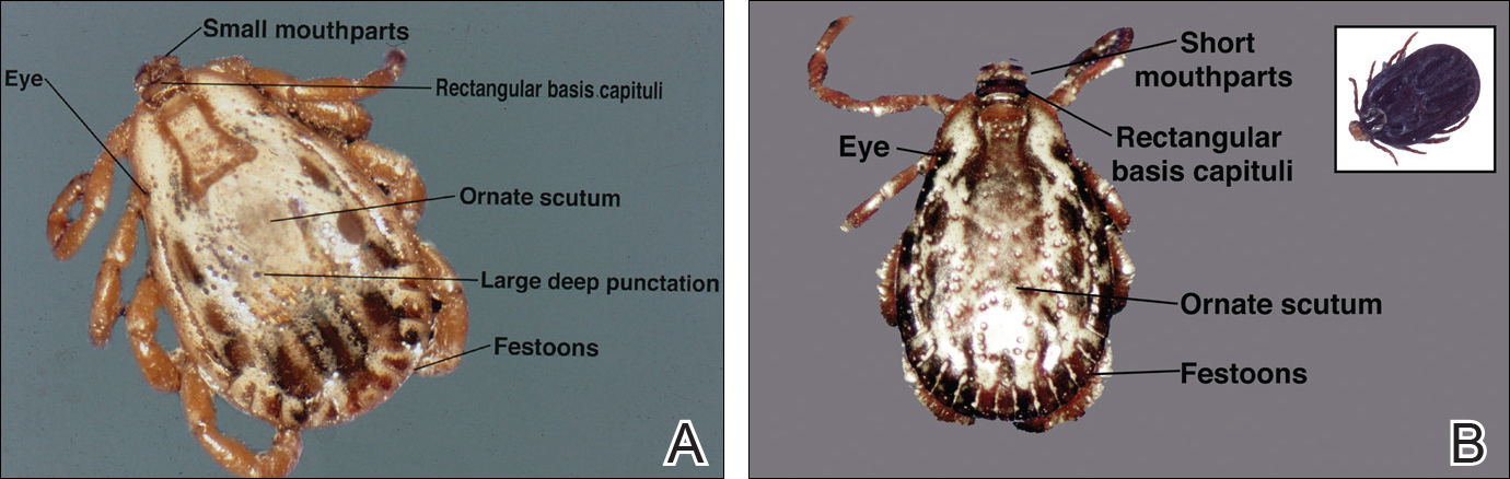 Microscopio Dermacentor Variabilis Dog Tick Electron Hi Res Stock