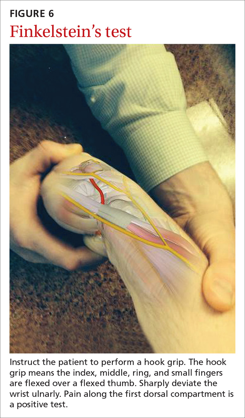 Hand and arm pain: A pictorial guide to injections | MDedge Family Medicine