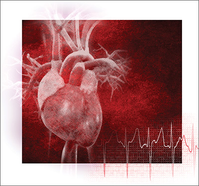 Atrial fibrillation: Effective strategies using the latest tools ...