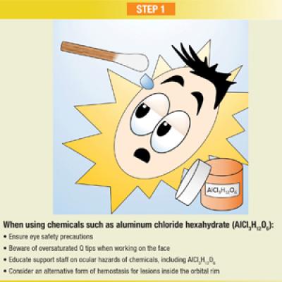 Infographic: Step-by-Step Guide to Managing Ocular Chemical Burns ...